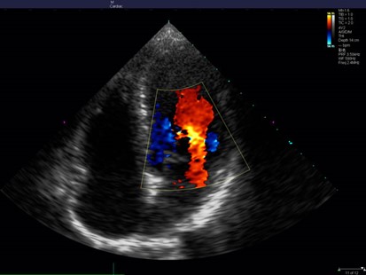 Entendiendo el Doppler – MonKeyEM
