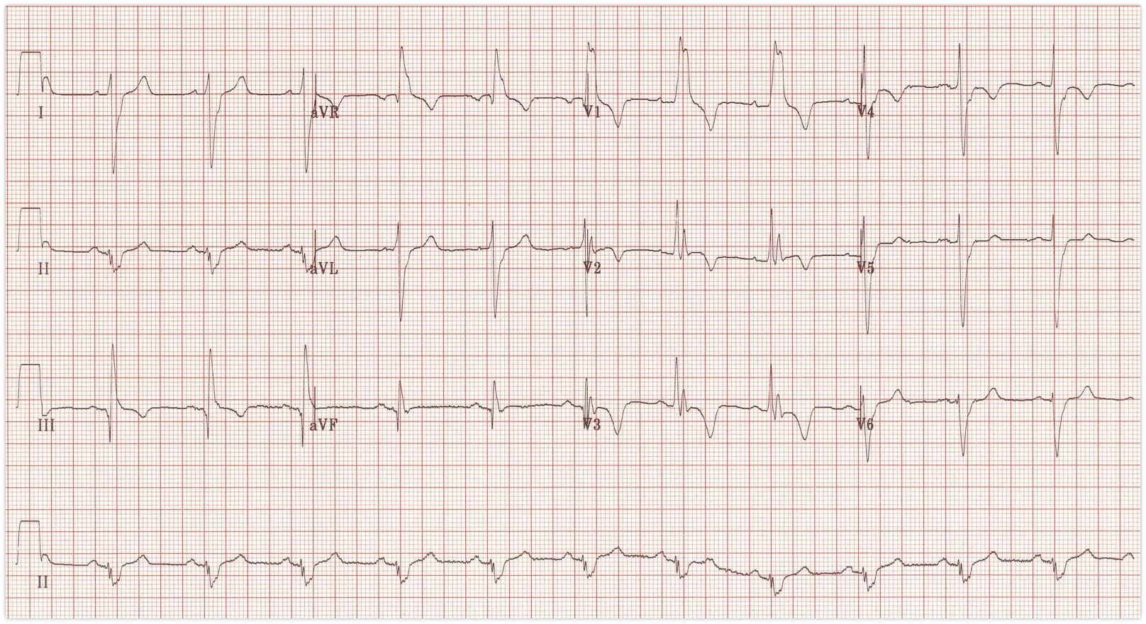 EKG – TEP – MonKeyEM