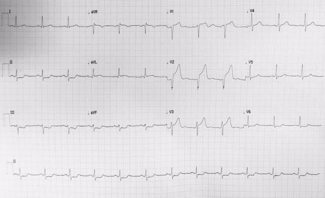 MonkeyQuiz – EKG – MonKeyEM